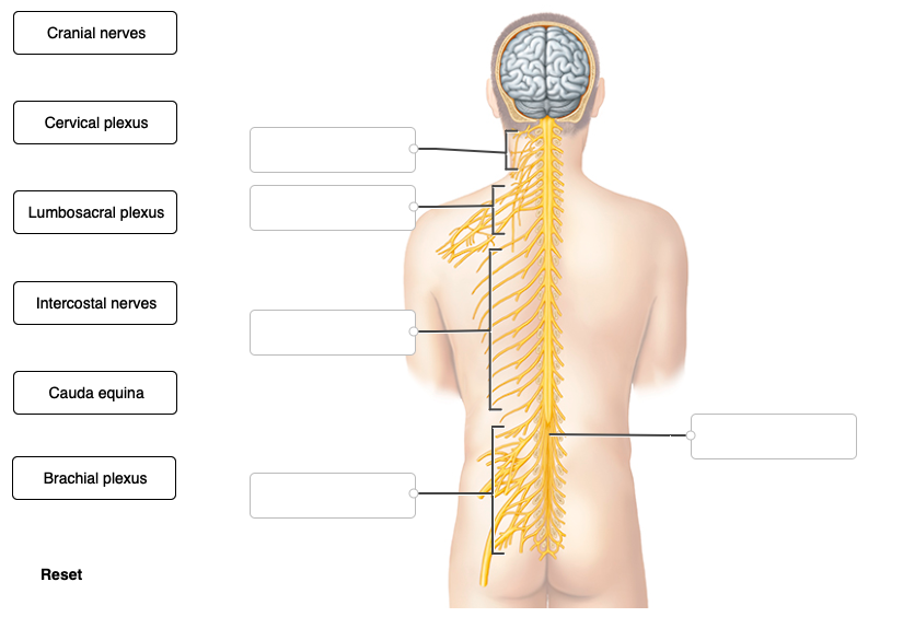 Solved 1;-Each label lists some feature of, or event at, a | Chegg.com