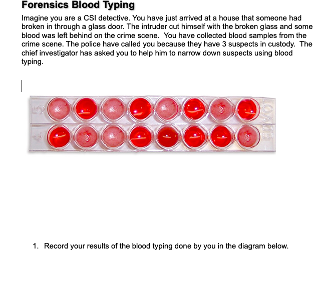 Solved Forensics Blood Typing Imagine you are a CSI | Chegg.com
