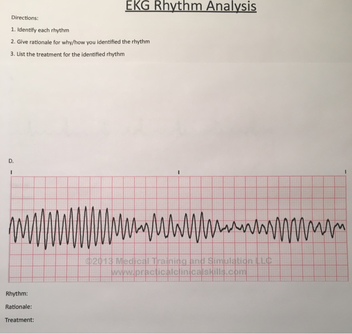 Solved EKG Rhythm Analysis Directions 1. Identify each | Chegg.com