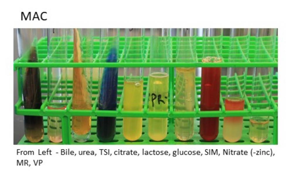 Solved PEA TI From Left - Bile, urea, TSI, citrate, lactose, | Chegg.com