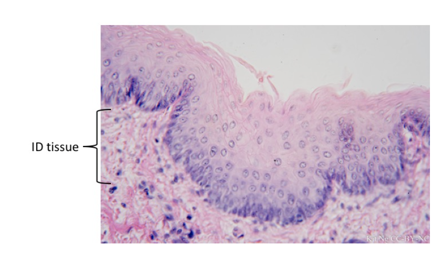 Solved ID Tissue | Chegg.com