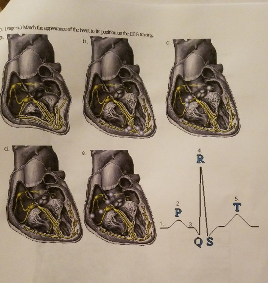 Solved 6.) Match the appearance of the heart to its position | Chegg.com
