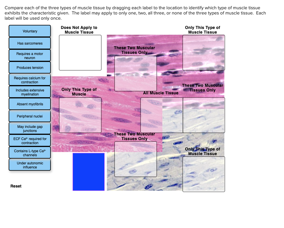 Solved Compare each of the three types of muscle tissue by | Chegg.com