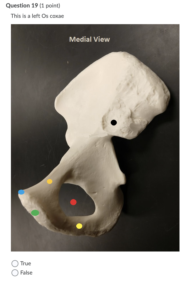 Solved Question 19 (1 point) This is a left Os coxae Medial | Chegg.com