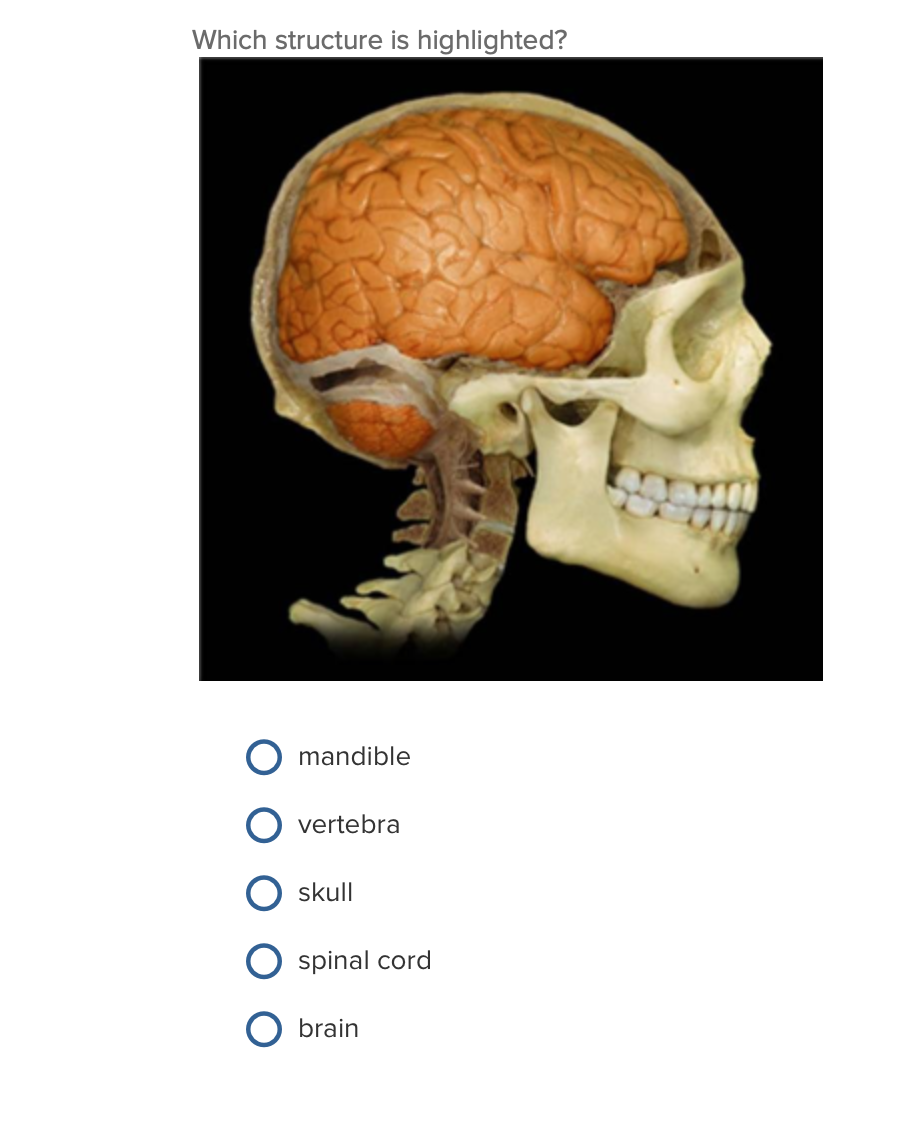Solved Which structure is highlighted? third ventricle | Chegg.com