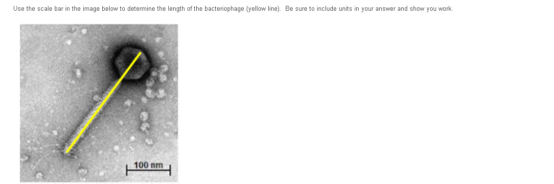 Solved Use the scale bar in the image below to determine the | Chegg.com