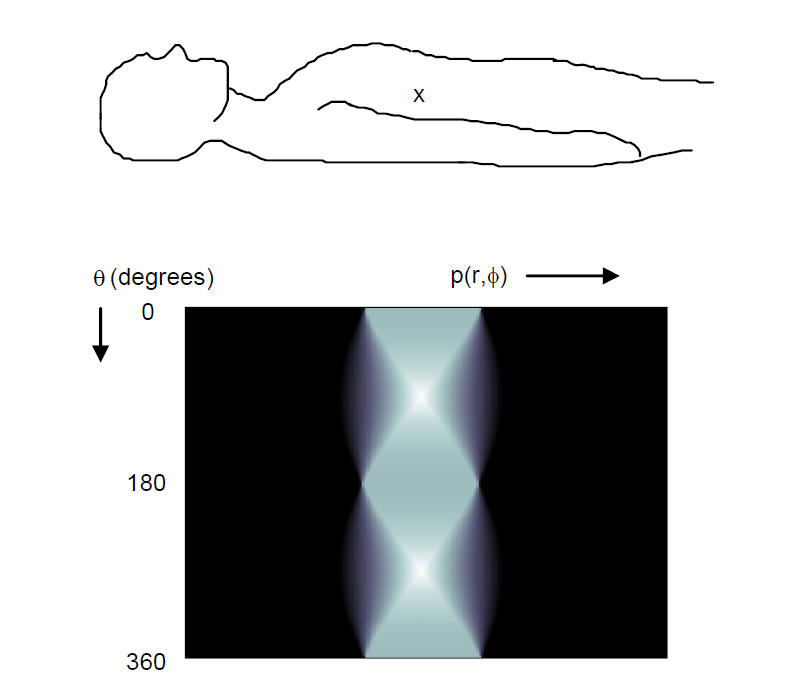 Solved 3. A SPECT scan is taken of a patient, and an area of | Chegg.com