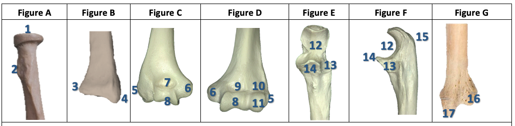 Solved Label the upper limb bone & portion | Chegg.com