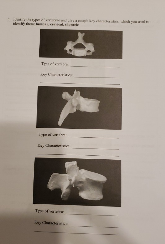 Solved 5. Identify the types of vertebrae and give a couple | Chegg.com