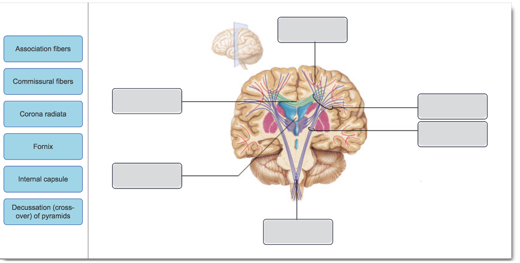 Solved Association fibers Commissural fibers Corona radiata | Chegg.com