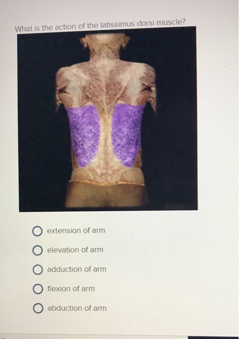 Solved Which structure is highlighted? O triceps brachil O | Chegg.com