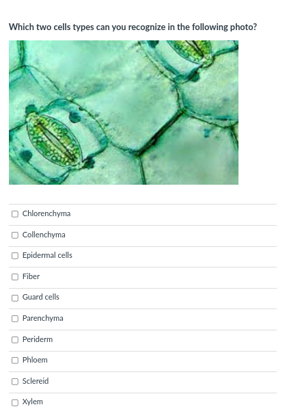 Solved Which two cells types can you recognize in the | Chegg.com