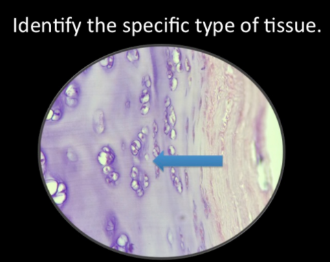 Solved Identify the specific type of tissue. Identify the | Chegg.com