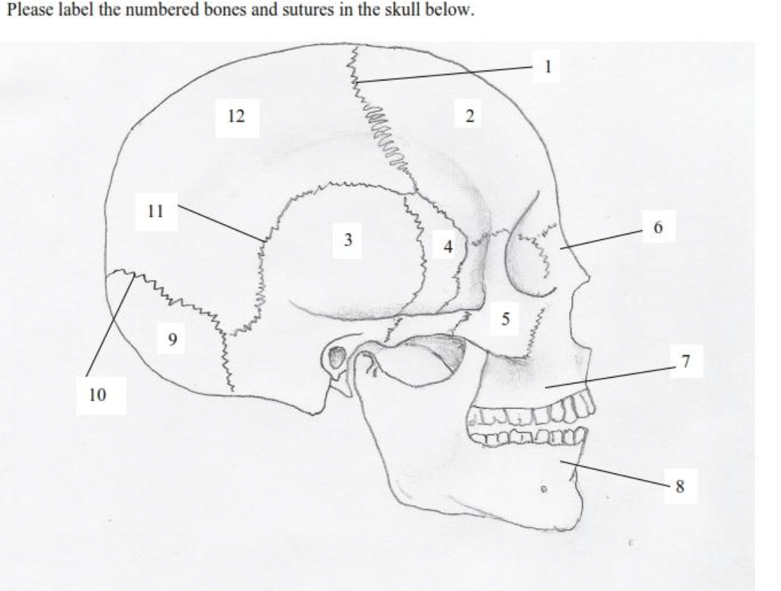 Solved Please label the diagram of the Haversian canal | Chegg.com