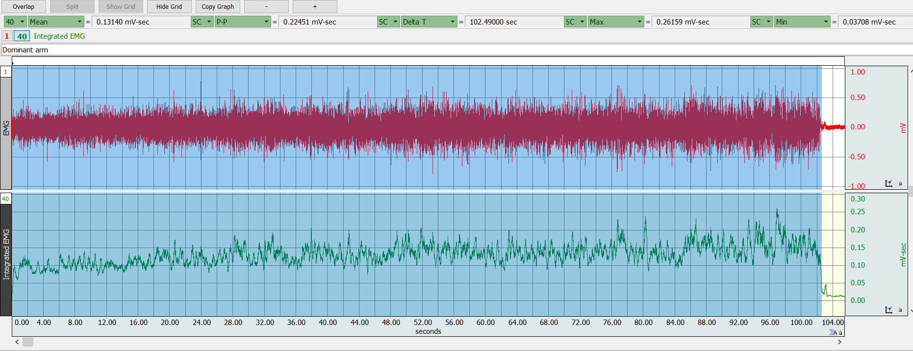 Solved What is the importance of knowing the Peak-to-Peak | Chegg.com