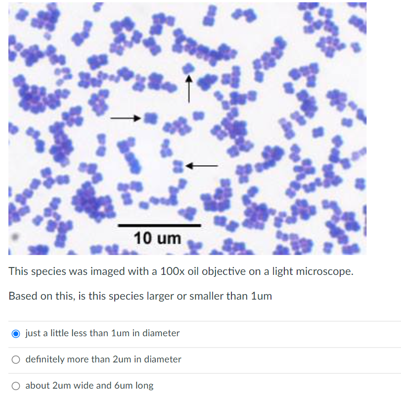 Solved 10 um This species was imaged with a 100x oil | Chegg.com