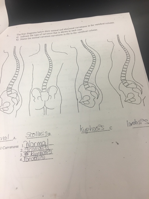 Solved The four diagrams below show normal and abnormal | Chegg.com