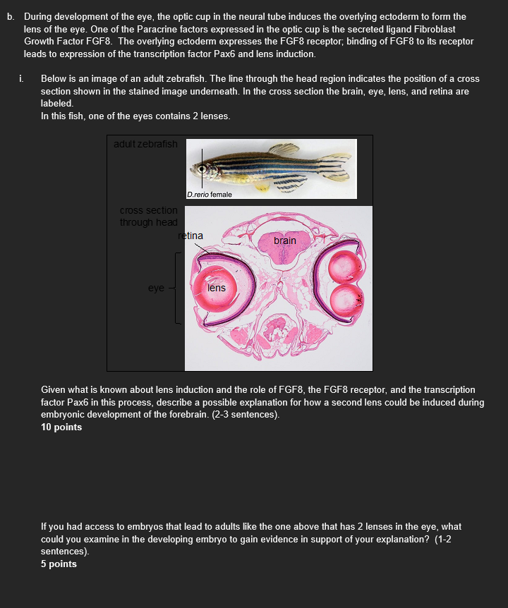 During development of the eye, the optic cup in the | Chegg.com