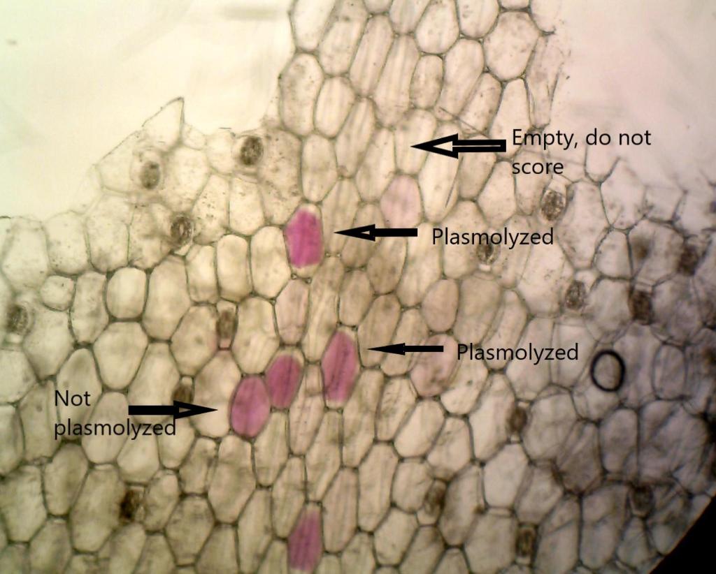 Solved Ignore cells devoid of any color. Plasmolysis is the | Chegg.com