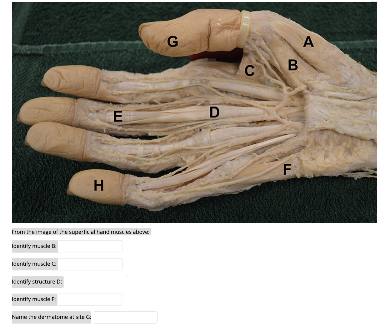 Solved From the image of the superficial hand muscles above: | Chegg.com