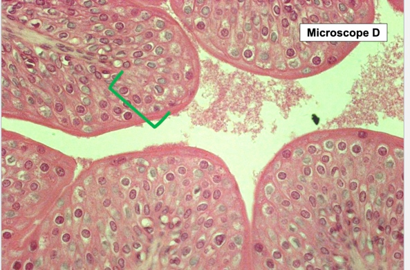 Solved Microscope D | Chegg.com