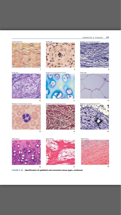 E. Epithelial and Connective Tissue Identification | Chegg.com E. Epithelial and Connective Tissue Identification | Chegg.com