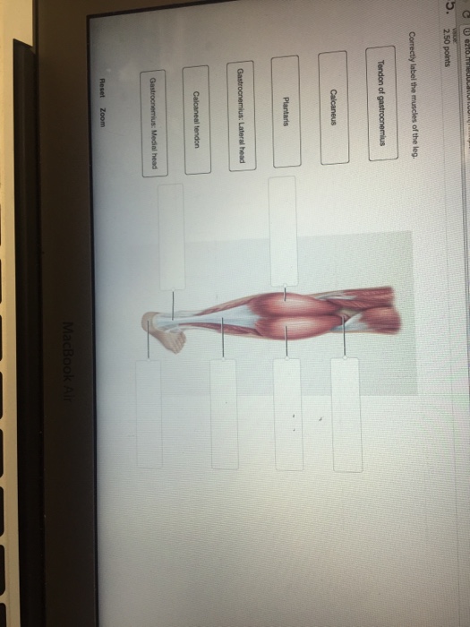 Solved Correctly label the muscles of the leg. | Chegg.com