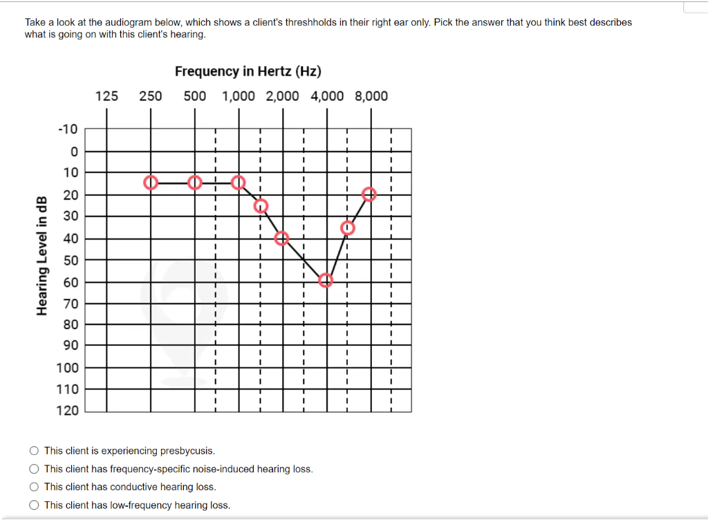 Solved Take a look at the audiogram below, which shows a | Chegg.com