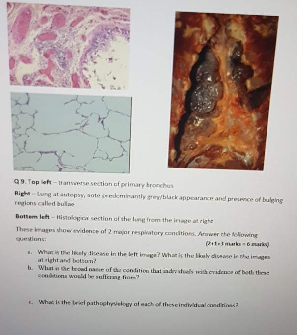 Solved Q9. Top left-transverse section of primary bronchus | Chegg.com