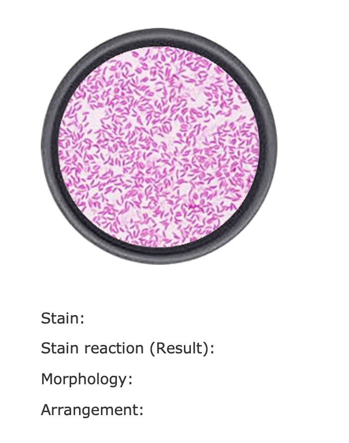 Solved W * Stain: Stain reaction (Result): Morphology: | Chegg.com