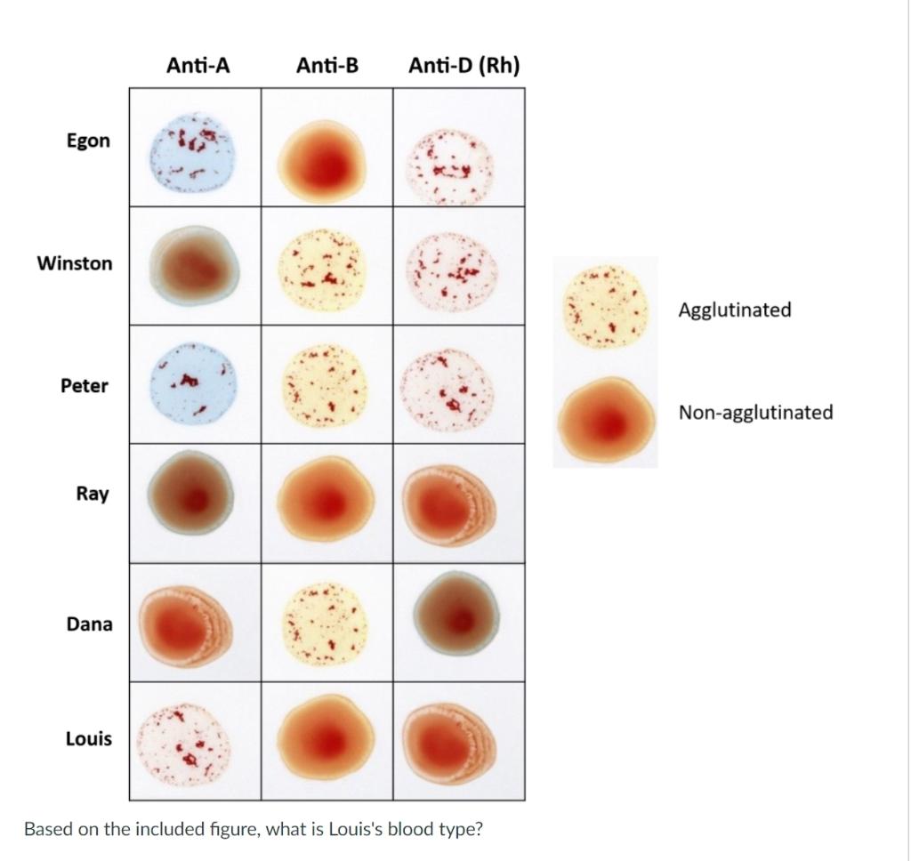 Solved Anti-A Anti-B Anti-D (Rh) Egon Winston Agglutinated | Chegg.com