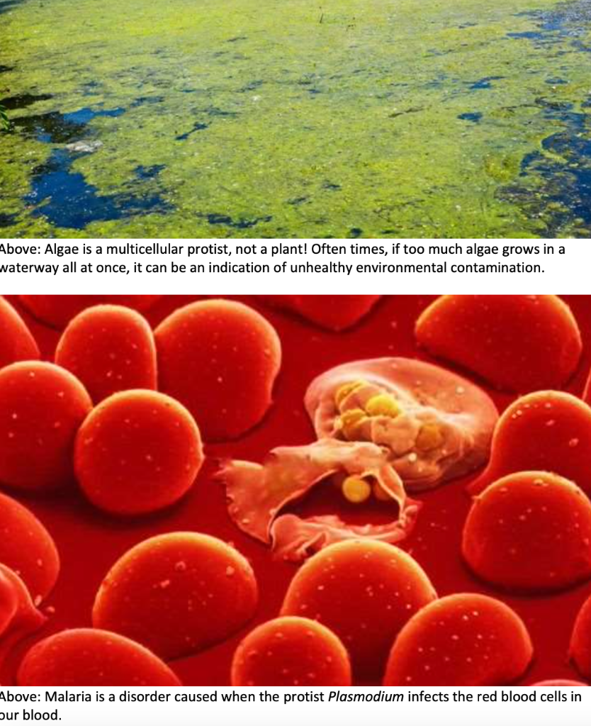 Solved Activity \#4: Single Celled Eukaryotes - Protists | Chegg.com