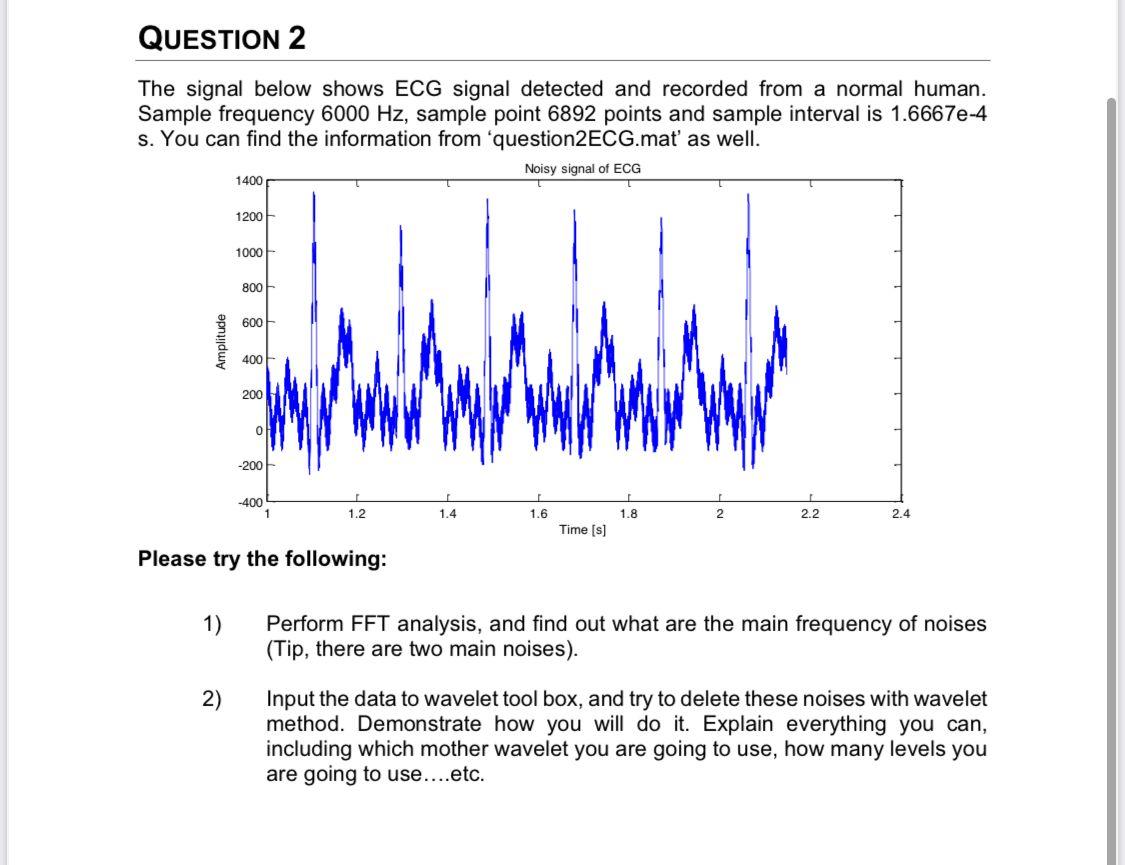 Solved QUESTION 2 The signal below shows ECG signal detected | Chegg.com