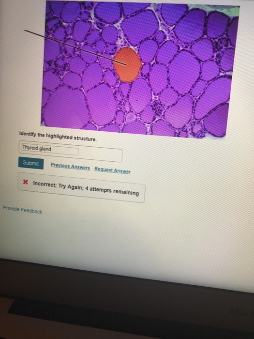 Solved Identify the highlighted structure. Thyroid gland | Chegg.com