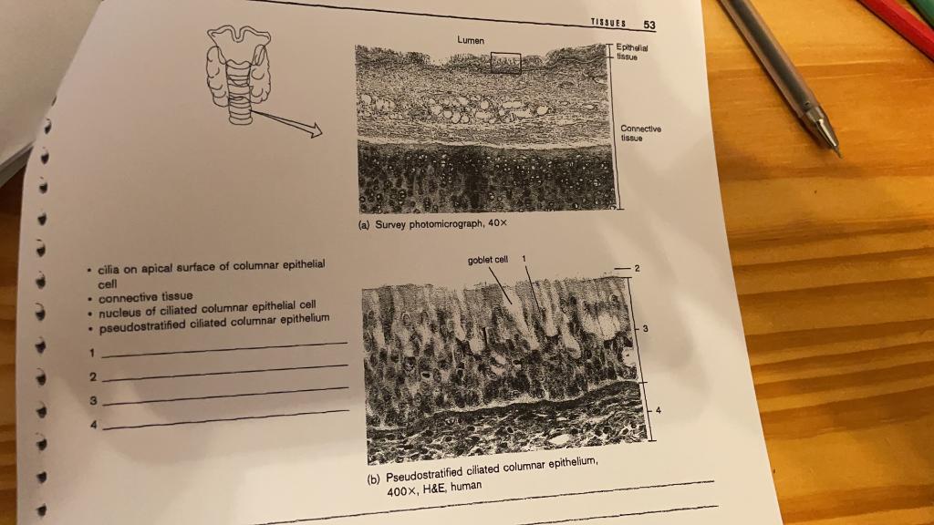 Solved Examine prepared microscope slides of the | Chegg.com