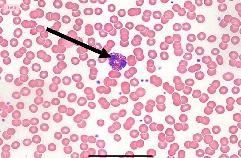 Solved 3 of 3 CHAPTER 7 - PERIPHERAL BLOOD Histology Guide | Chegg.com
