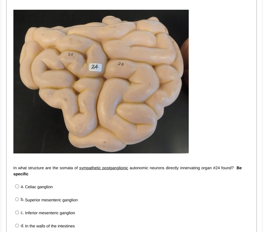 Solved In what structure are the somata of sympathetic | Chegg.com