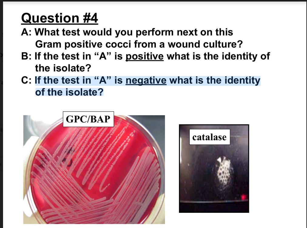 Solved B: What additional two (2) tests would you perform to | Chegg.com