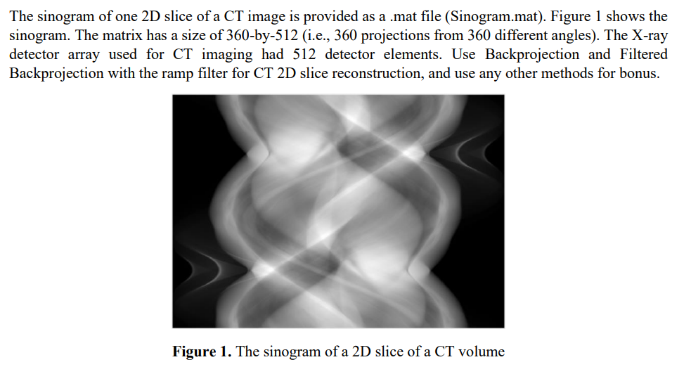 Solved The sinogram of one 2D slice of a CT image is | Chegg.com