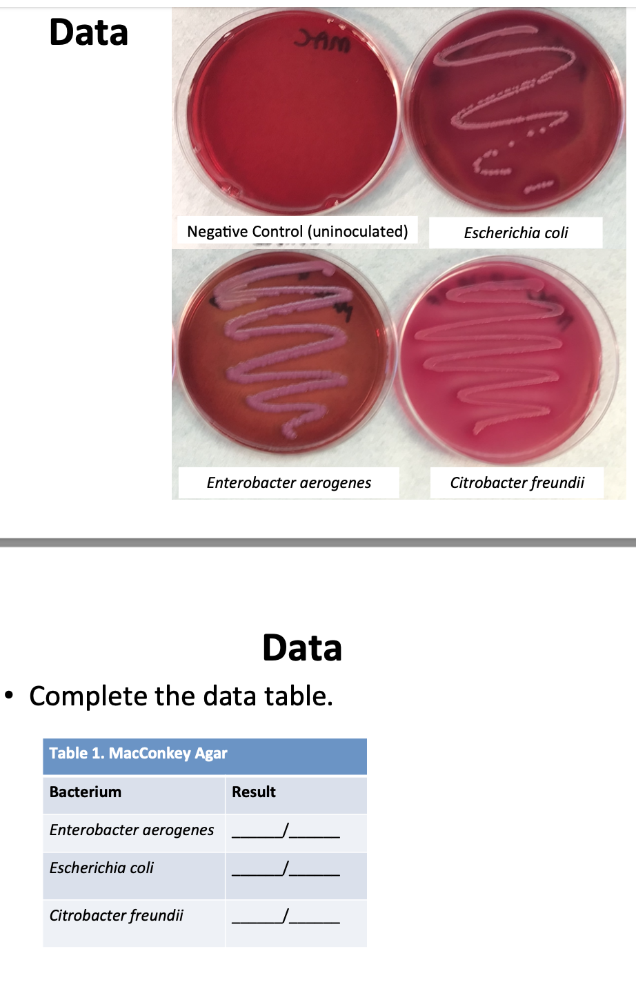 Macconkey Agar Enterobacter Aerogenes