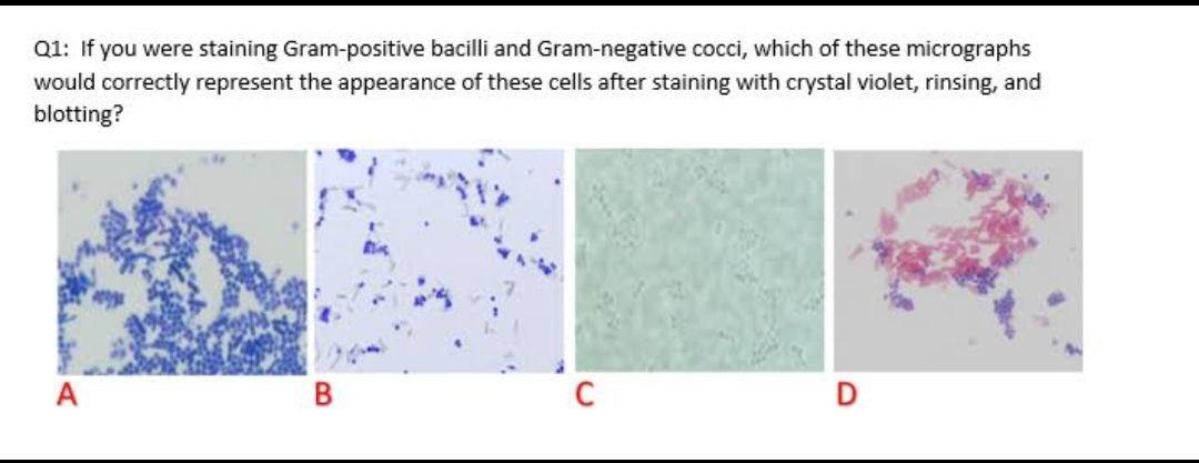 Solved Q1: If you were staining Gram-positive bacilli and | Chegg.com