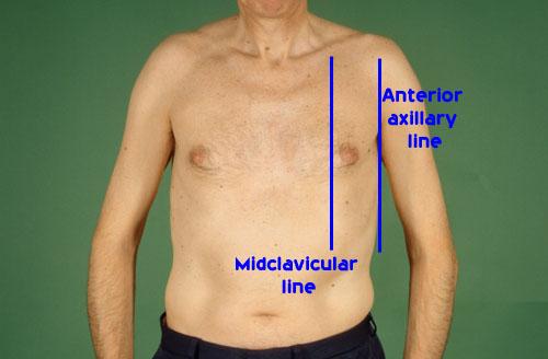 Anterior Axillary Line