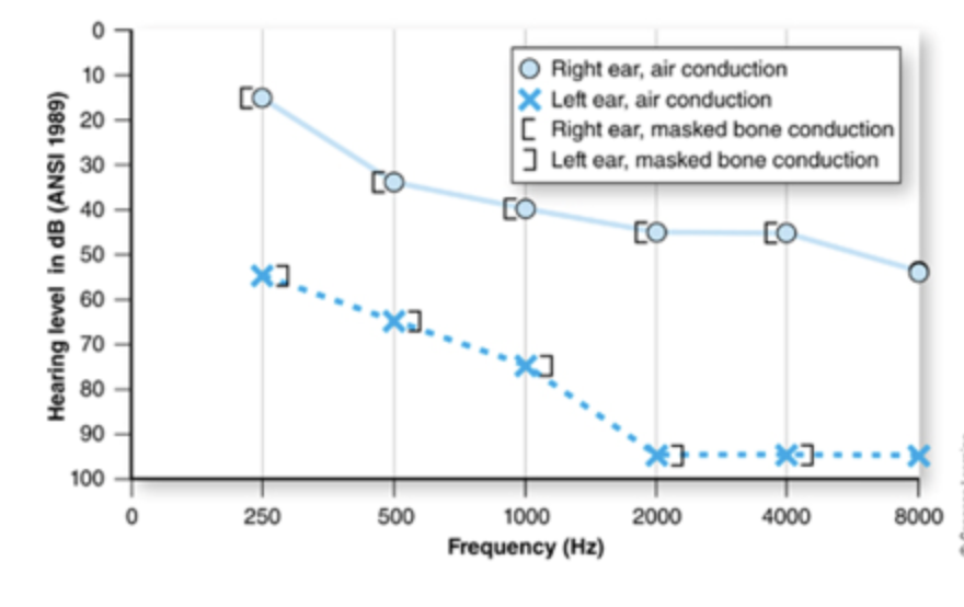 Solved After a hearing examination, an audiologist typically | Chegg.com