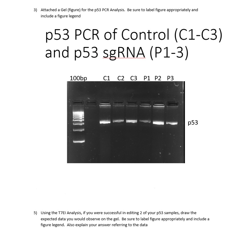 Solved 3) Attached a Gel (figure) for the p53 PCR Analysis. | Chegg.com