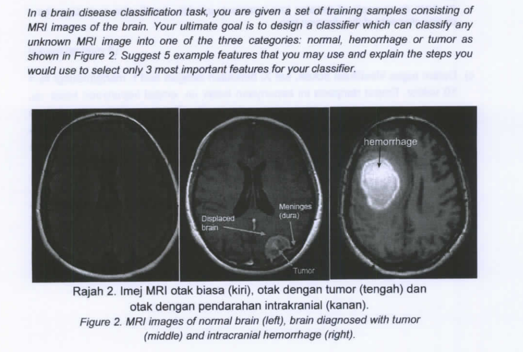 Solved In a brain disease classification task, you are given | Chegg.com