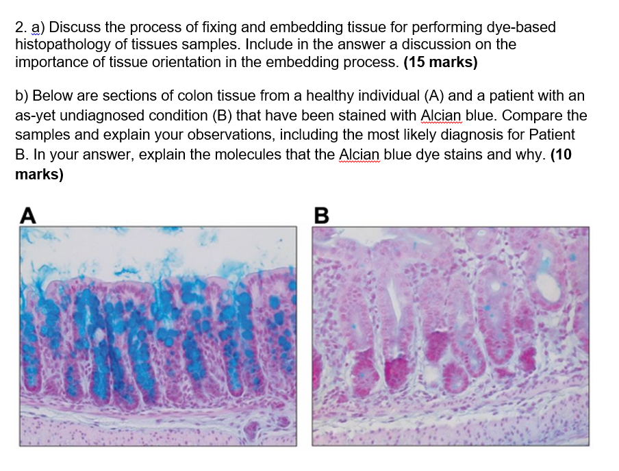 Solved 2. a) Discuss the process of fixing and embedding | Chegg.com