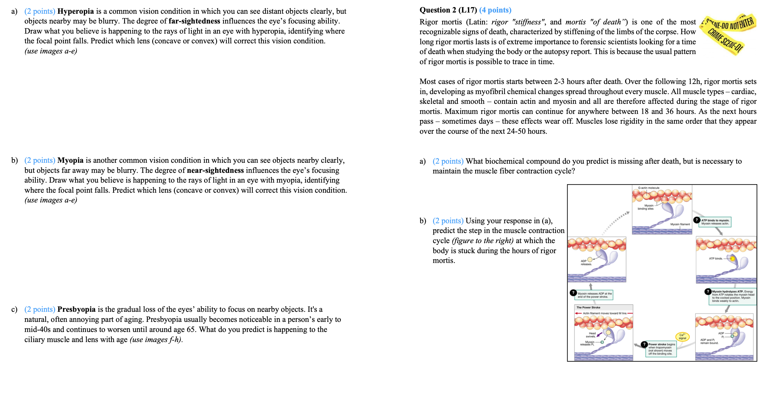 Solved Common vision defects can be corrected with external | Chegg.com