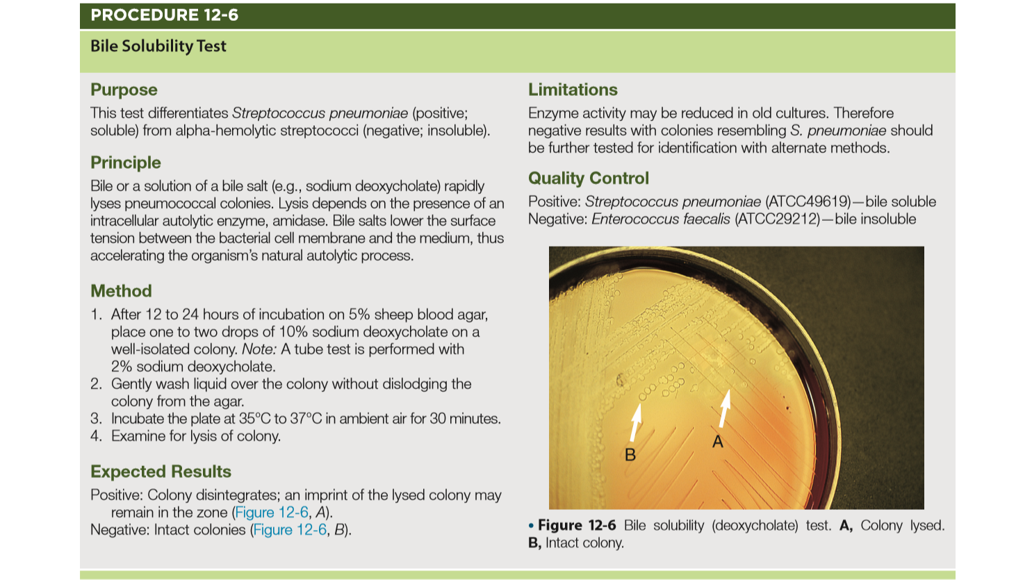 Bile Solubility Test