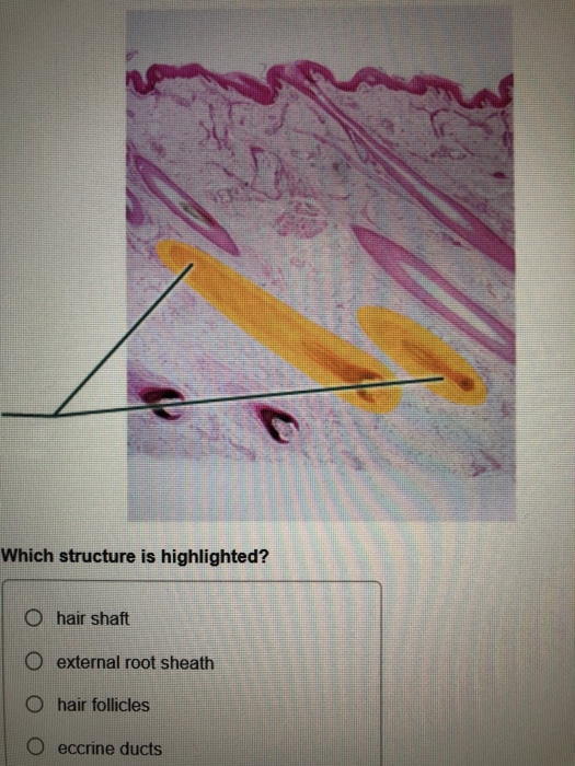 Solved Which structure is highlighted? O hair shaft O | Chegg.com