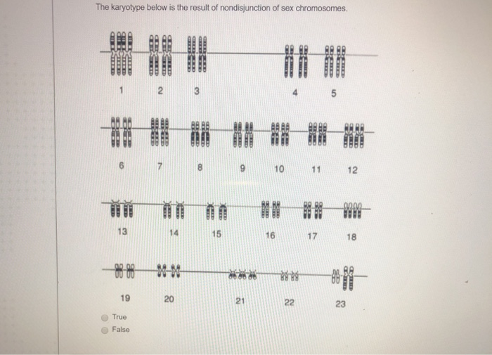 Nondisjunction Karyotype